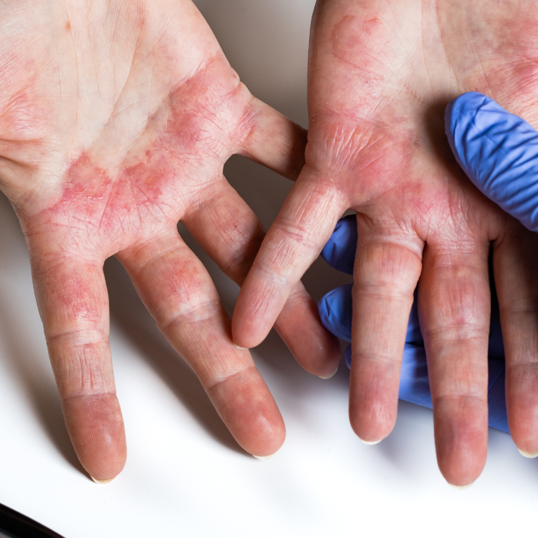 Dr. Julio Salas – Clínica Dermatologia en Monterrey